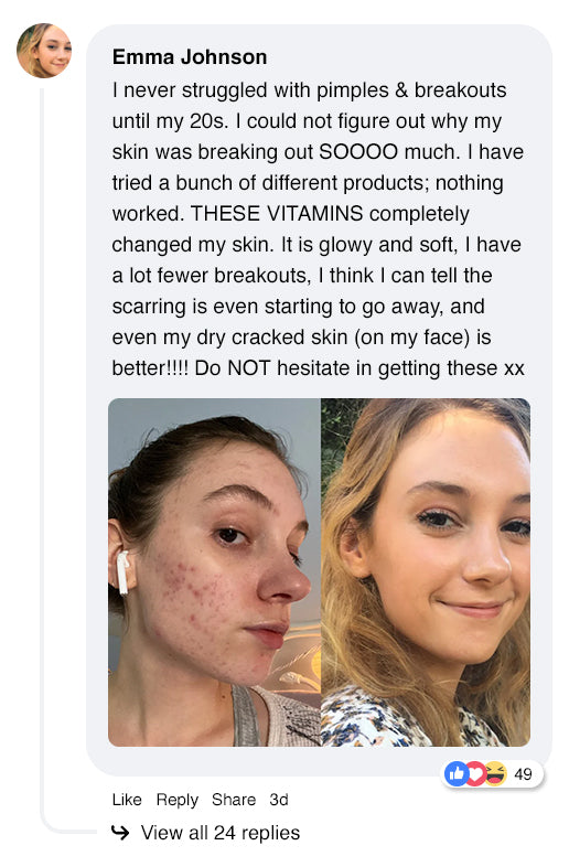 Skin Clear – Ovira