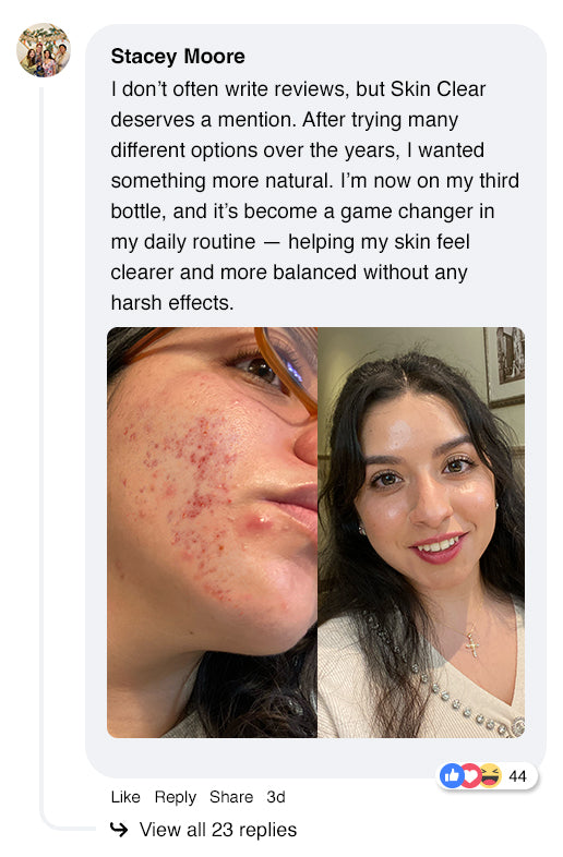 Ovira - Science-Backed Supplements for Women’s Gut & Hormone Health