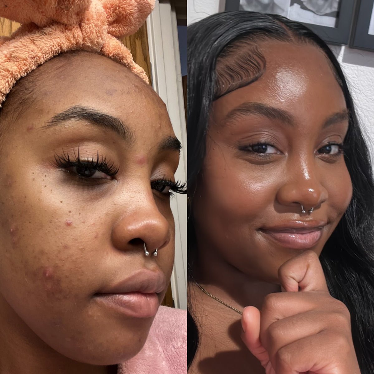 Skin Clear